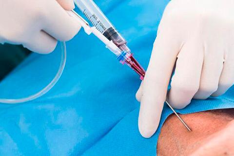 Paquetes Hospitalarios - San Francisco